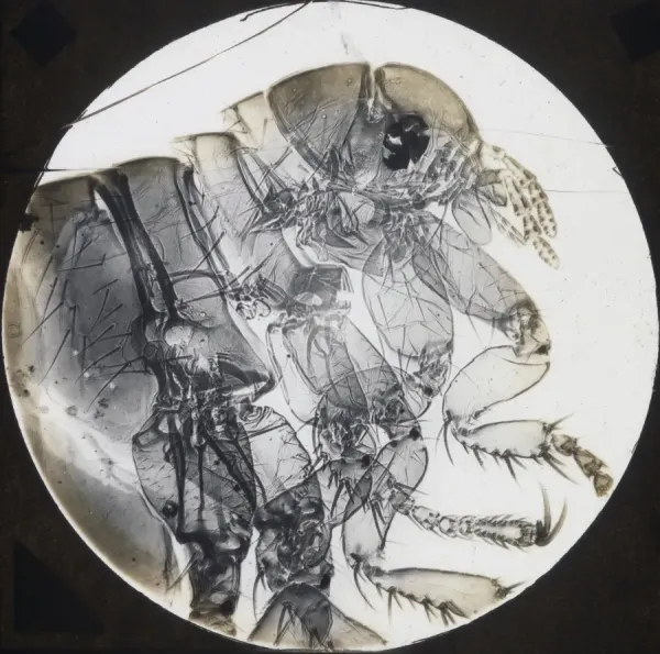 X-Ray Flea. Part of Box 165 Boswell Collection X-Rays
